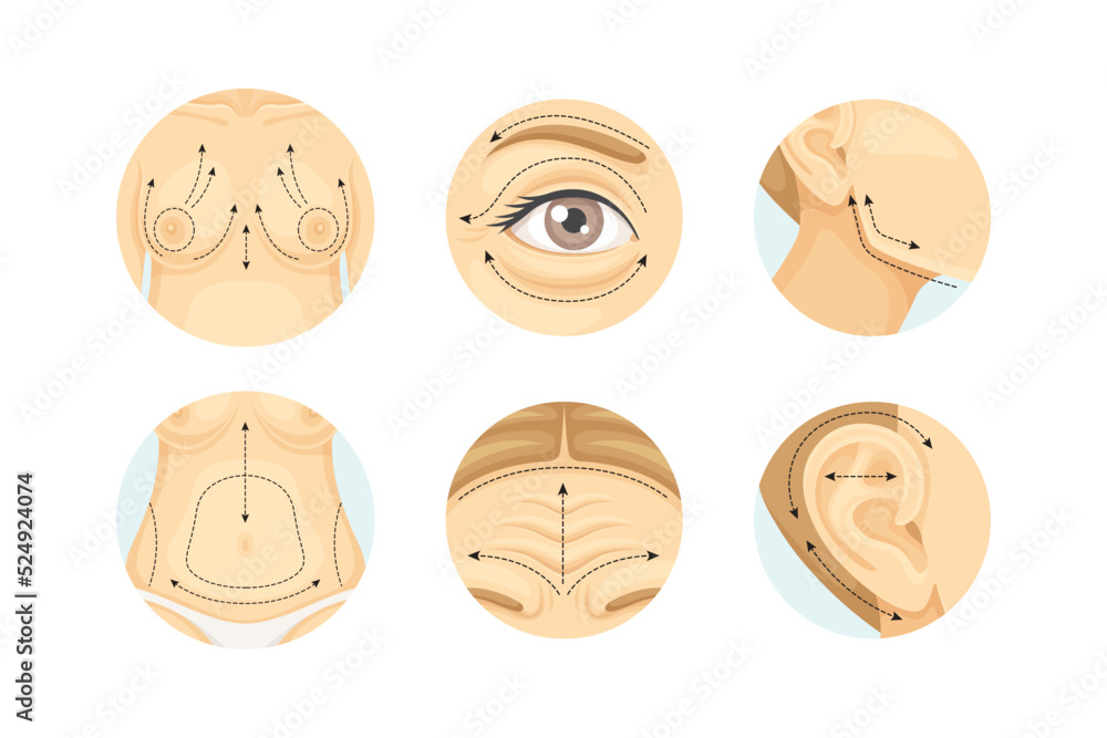 Plastic Surgery as Restoration and Reconstruction of Human Body Part in ...