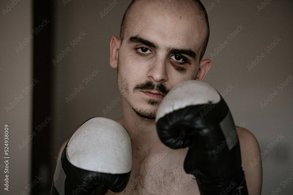 Young male with bruise under his eye with boxing gloves Stock Photo ...