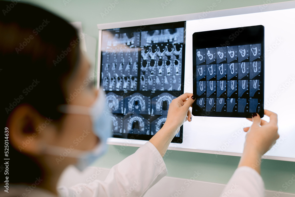 Crop dentist analyzing X ray image of teeth in hospital Stock Photo ...