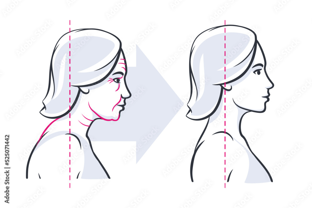 Womans face profile before and after. Young and elderly image of skin ...
