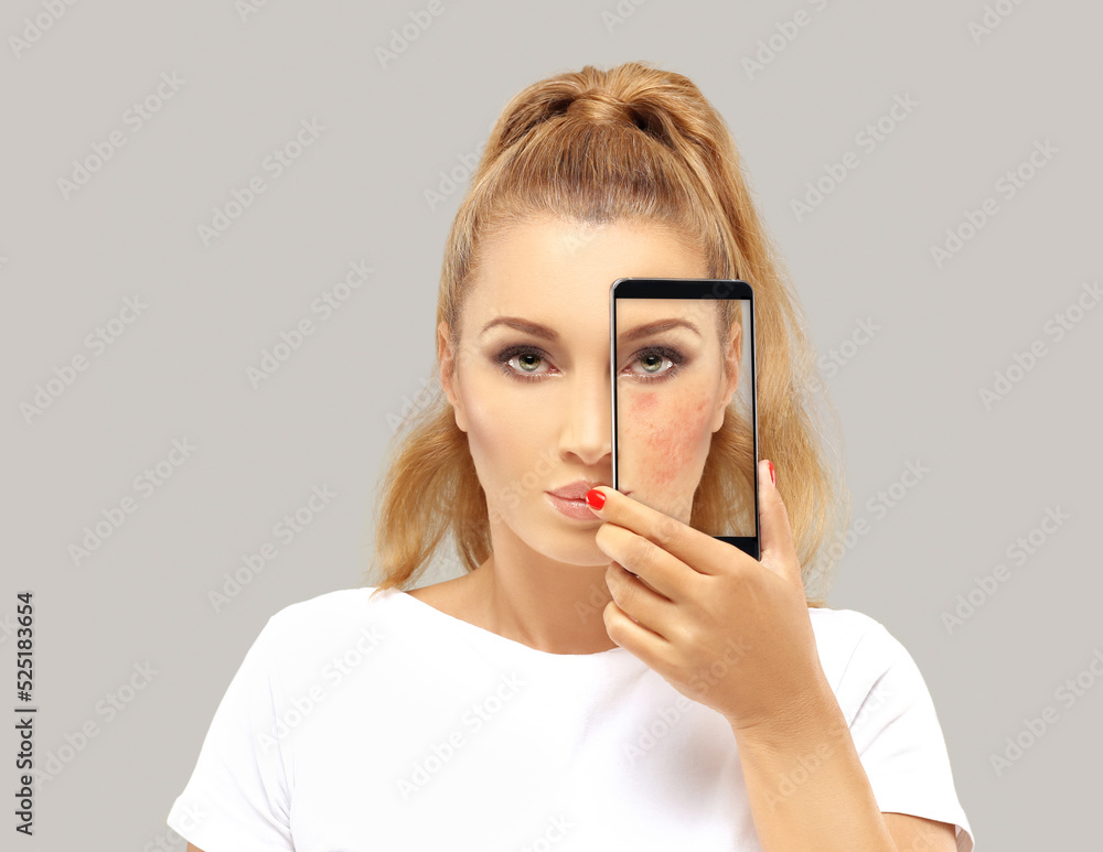 Acne,Skin concern,blemish-prone skin and acne, Rosacea,different types ...