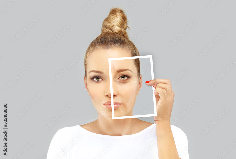 Effects of ageing,Frown scowl lines ,Nasolabial folds,Neck ,Under eye ...