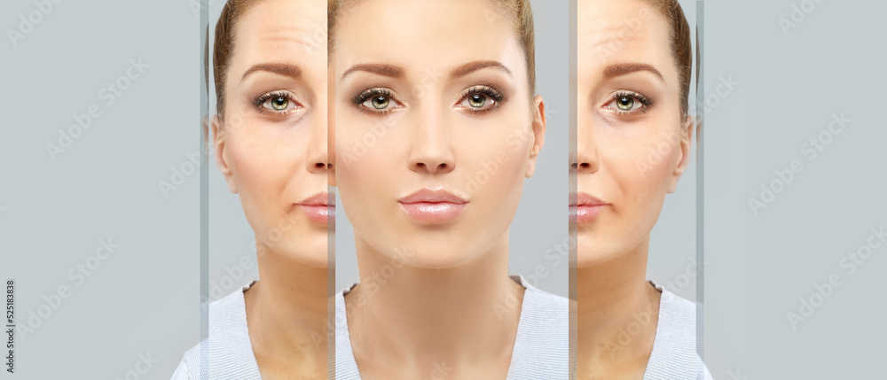 Effects of ageing,Frown scowl lines ,Nasolabial folds,Neck ,Under eye ...