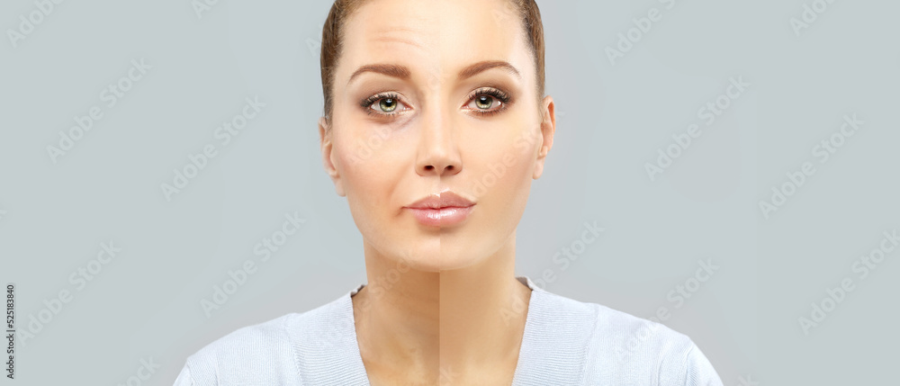 Effects of ageing,Frown scowl lines ,Nasolabial folds,Neck ,Under eye ...