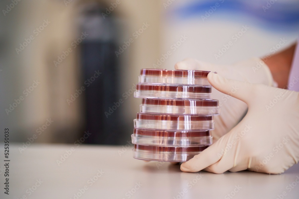 Laboratory worker holding a culture plate with bacteria or viruses ...