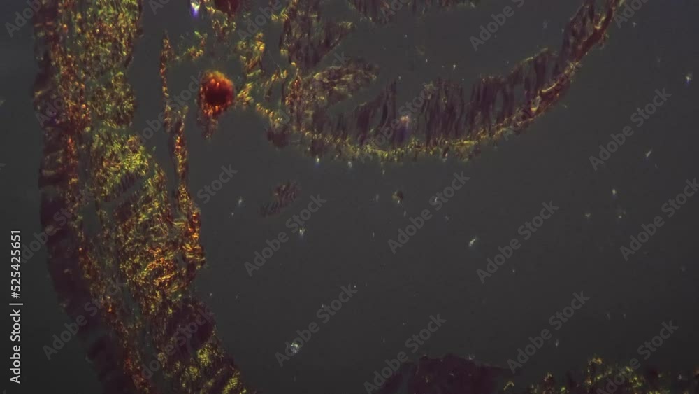 Earthworm cut in transversal section and magnified in 200 times under ...