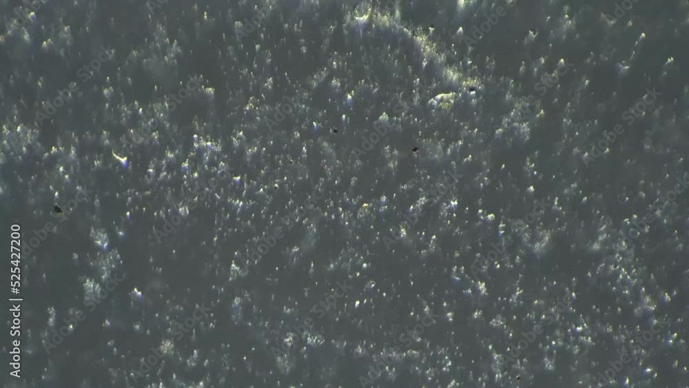 Eggs of Taenia solium whole mount magnified under microscope 100x ...