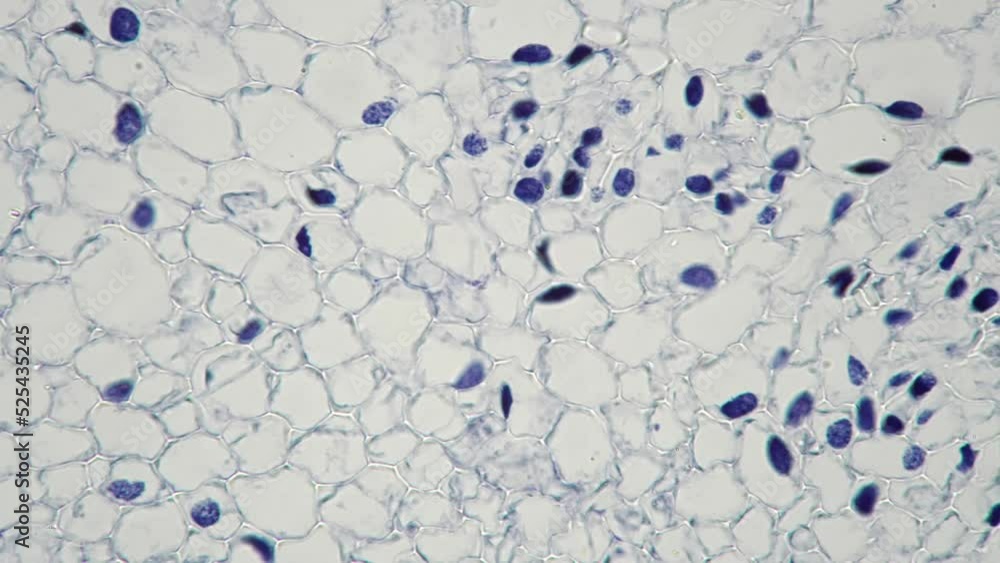 Ovary of Lilium T.S. under microscope 400x against bright field ...