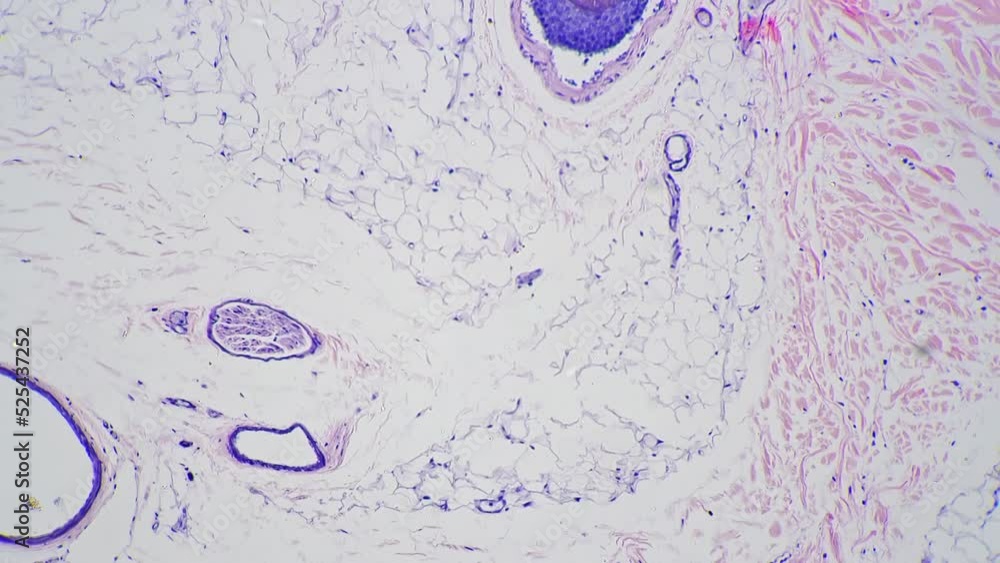 Skin of human shown with hair follicles in section filmed under ...