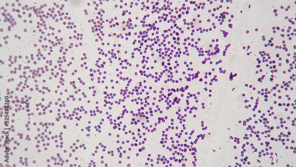 Smear of human blood under microscope with 200 times magnification on ...