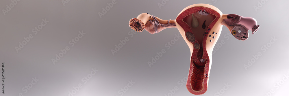 Anatomical model of uterus and ovaries, woman reproductive organs Stock ...