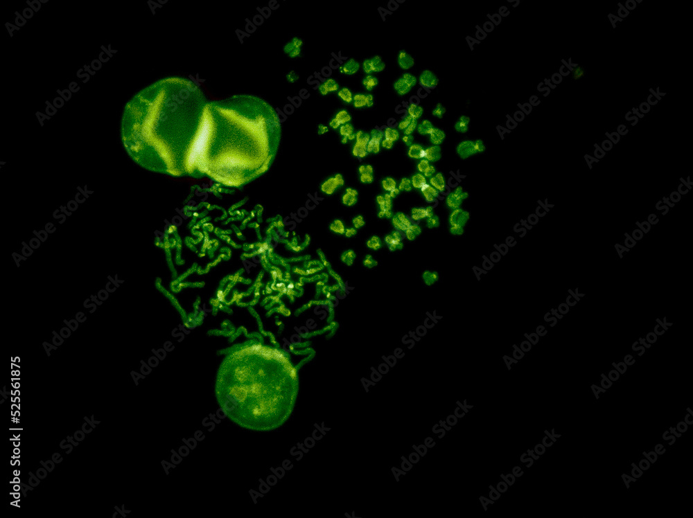 Chromosomes under fluorescence microscope, green colored Human ...