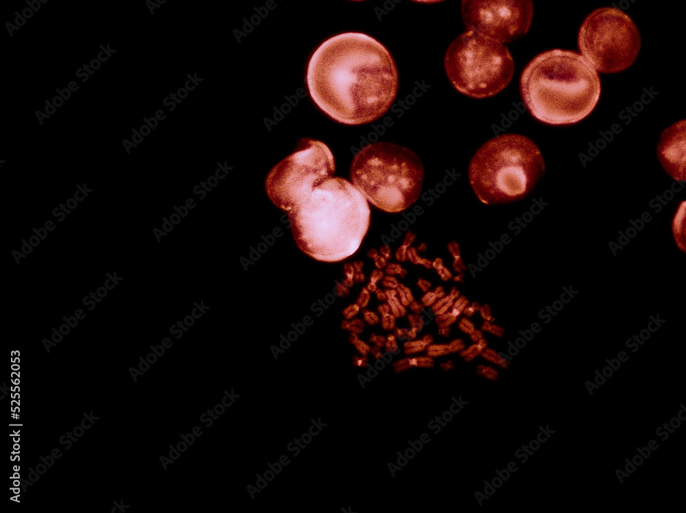 Chromosomes under fluorescence microscope, red colored Human ...
