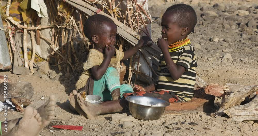 Close-up.Malnourished children due to extreme poverty, drought and ...