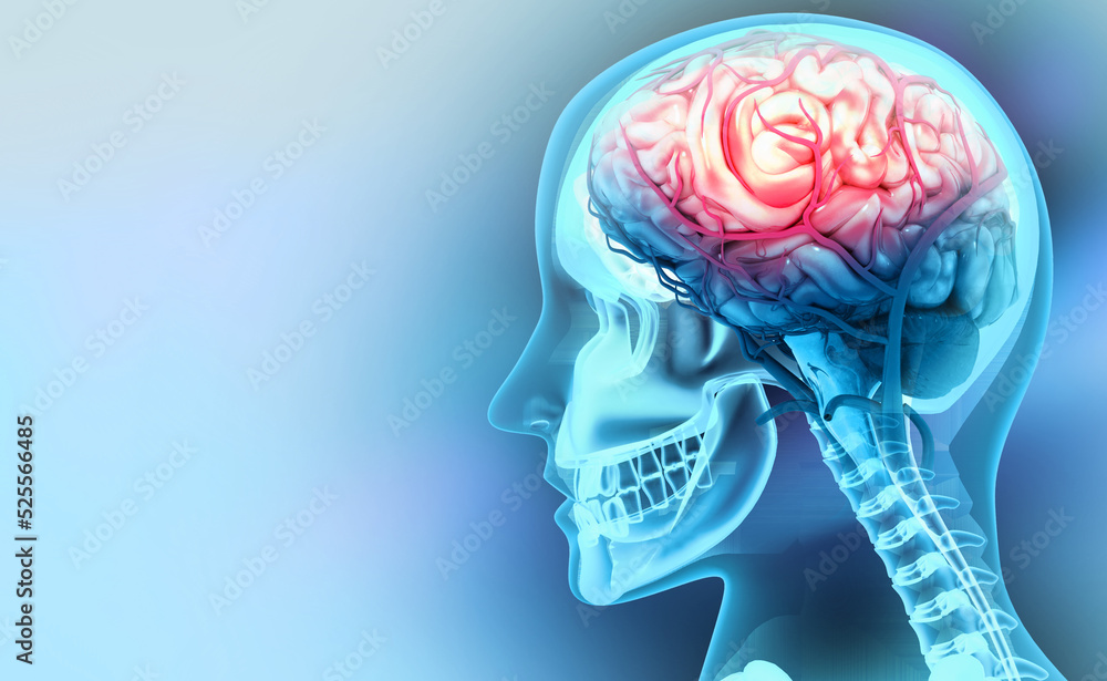Human brain injury,damage,hemorrhage. 3d illustration Stock ...