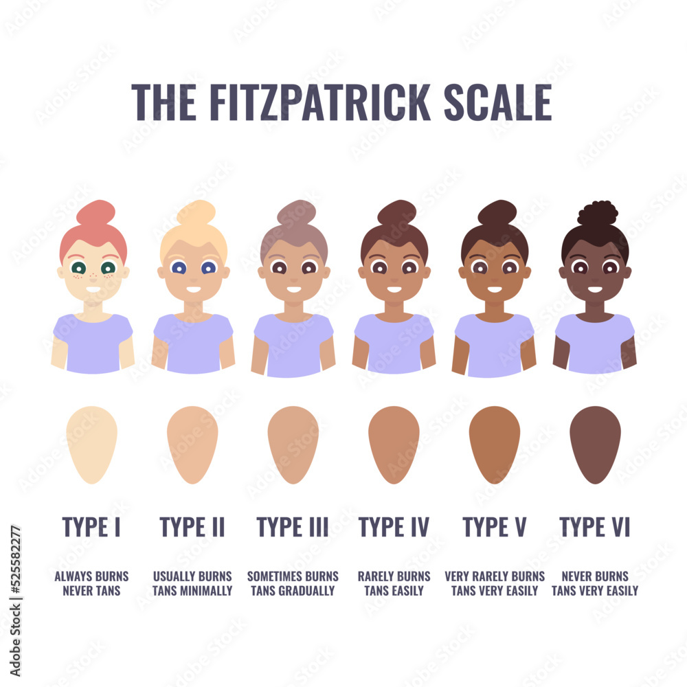 Fitzpatrick Skin Type Classification Scale Shown In Women Human Skin 