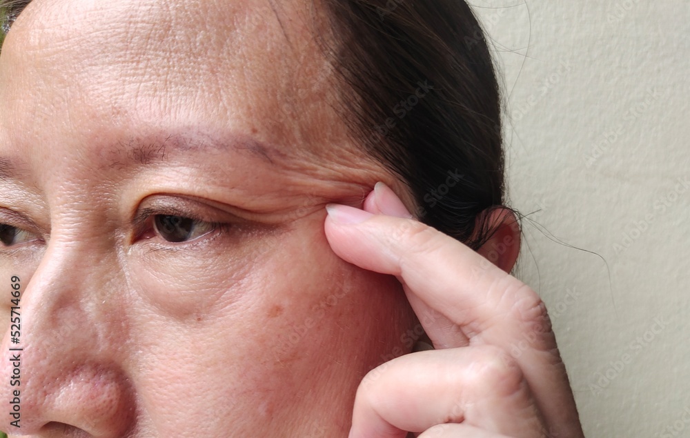 Portrait showing the fingers pointing the Wrinkles and flabby skin ...