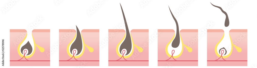 Cross section of hair growth cycle steps. Vector illustration isolated ...