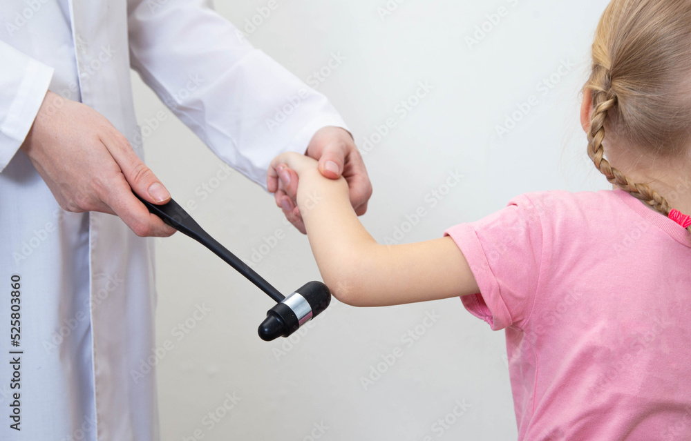 Checking the child's elbow reflex with a neurological hammer, close-up ...