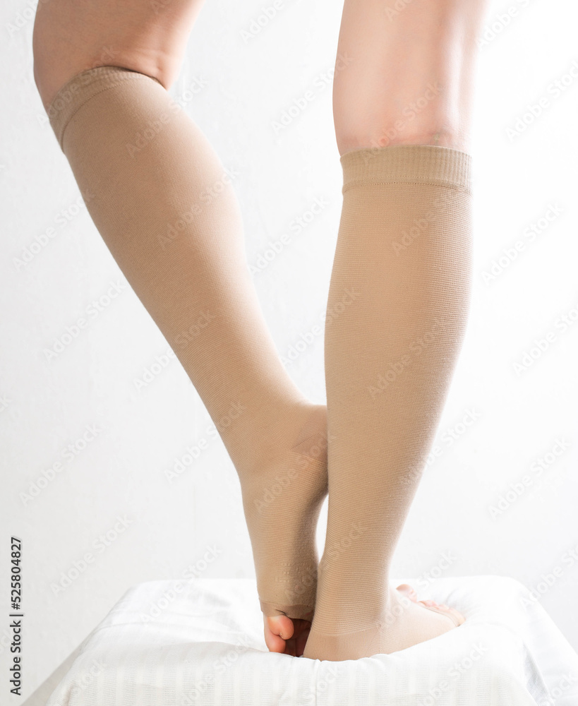 Female legs in compression stockings for varicose veins on the legs ...