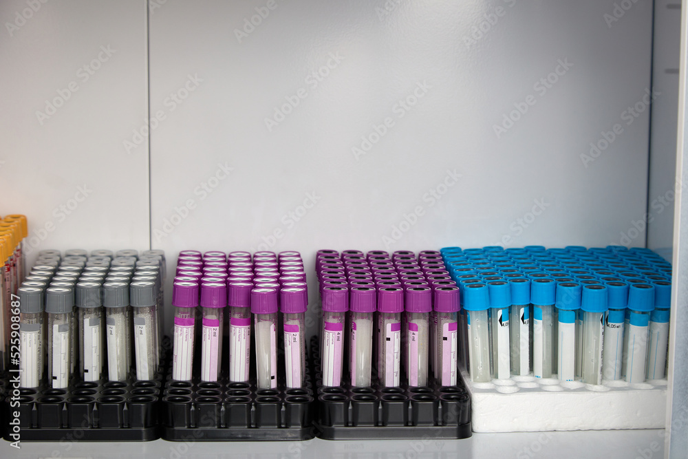 Rack with empty vacuum tubes with lids of different colors for ...