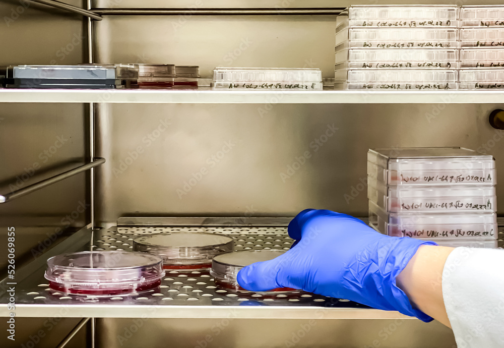 A scientist reaching for a stack of plates with growing cancer cells ...