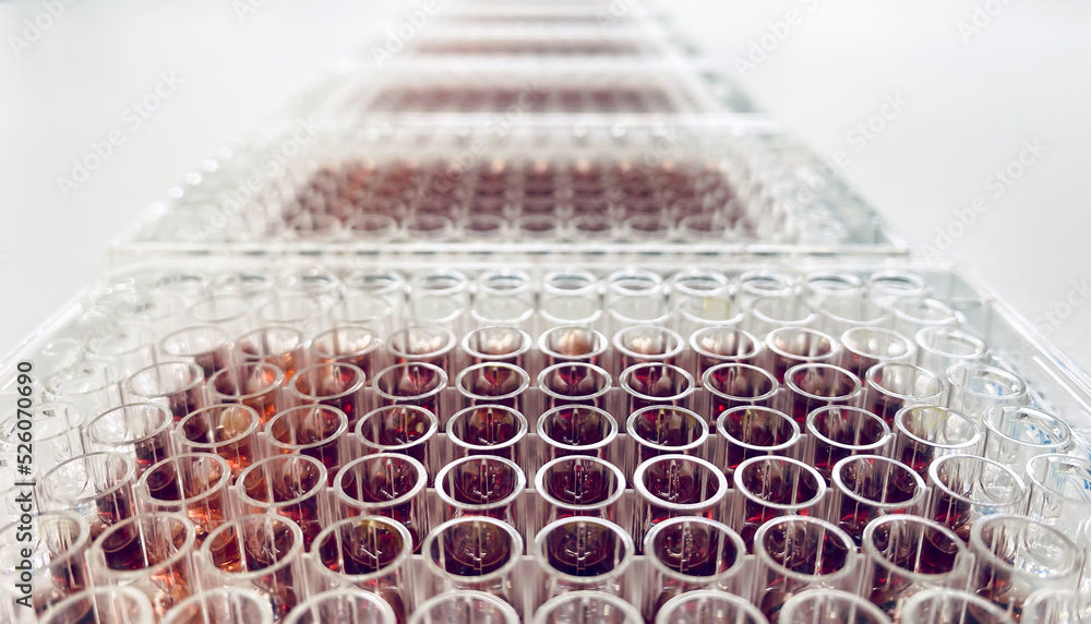 A panel of 96-well plates used for drug activity evaluation in a cancer ...