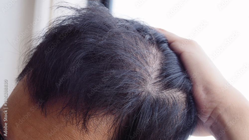 Young Asian man using his hand slicking his hair back after facing hair ...
