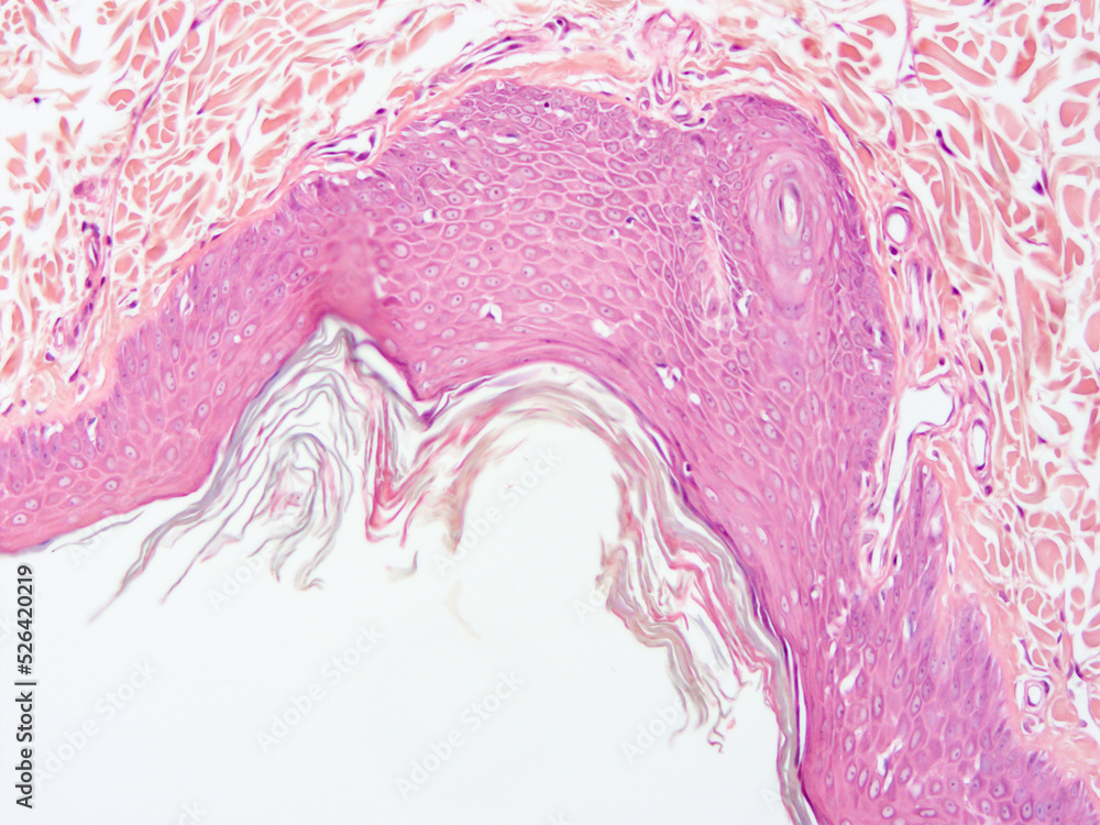 Histology of human tissue, show epithelial tissue and connective tissue ...