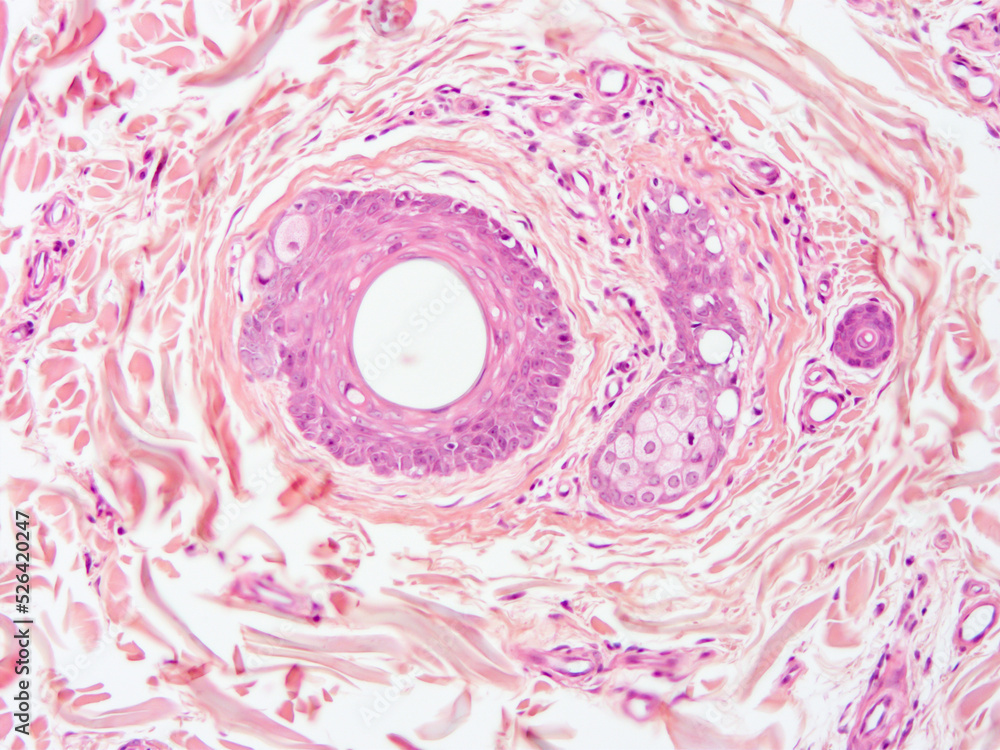 Histology of human tissue, show epithelial tissue and connective tissue ...