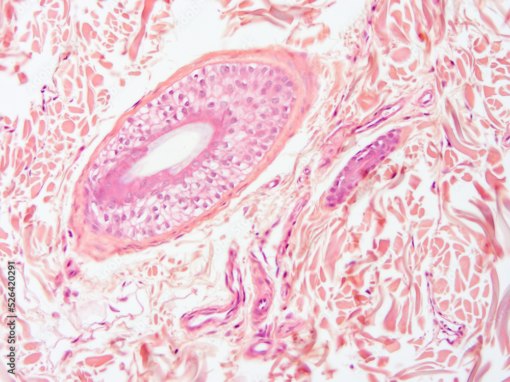Histology of human tissue, show epithelial tissue and connective tissue ...