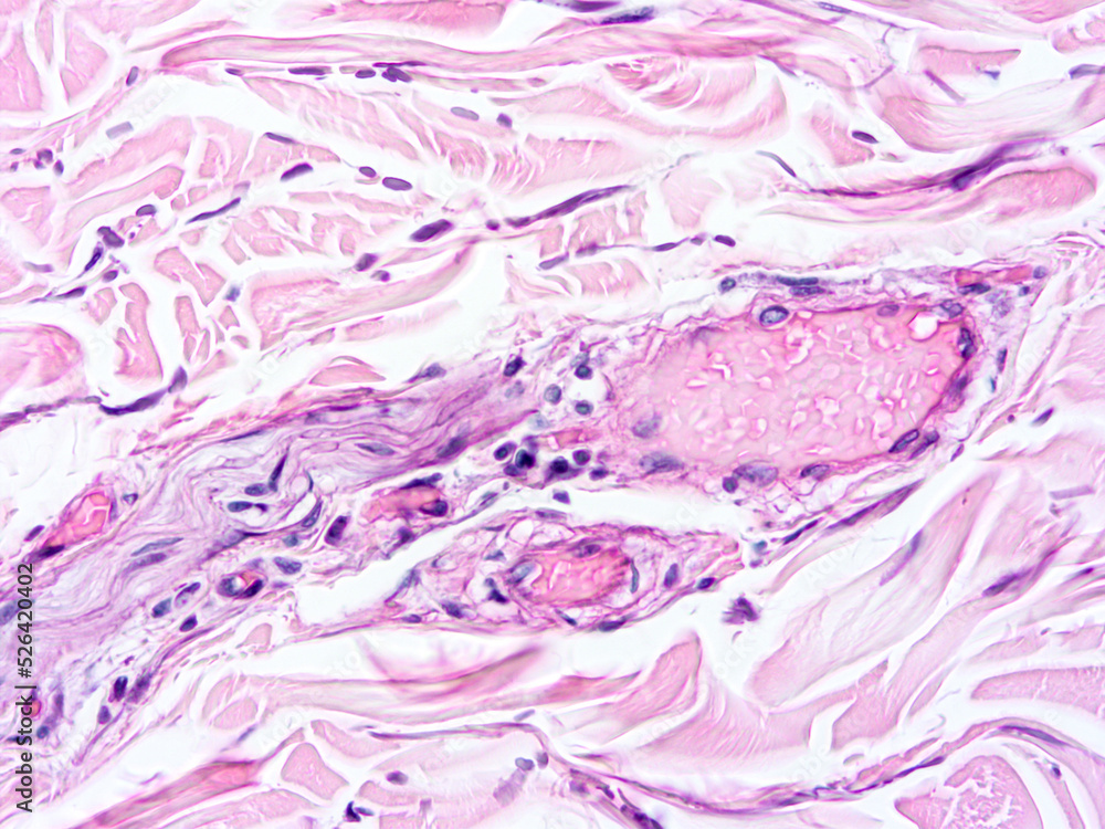 Histology of human tissue, show epithelial tissue and connective tissue ...