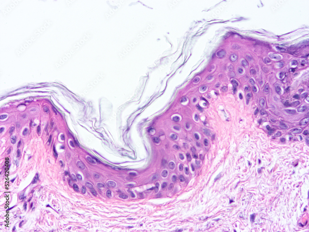 Histology of human tissue, show epithelial tissue and connective tissue ...
