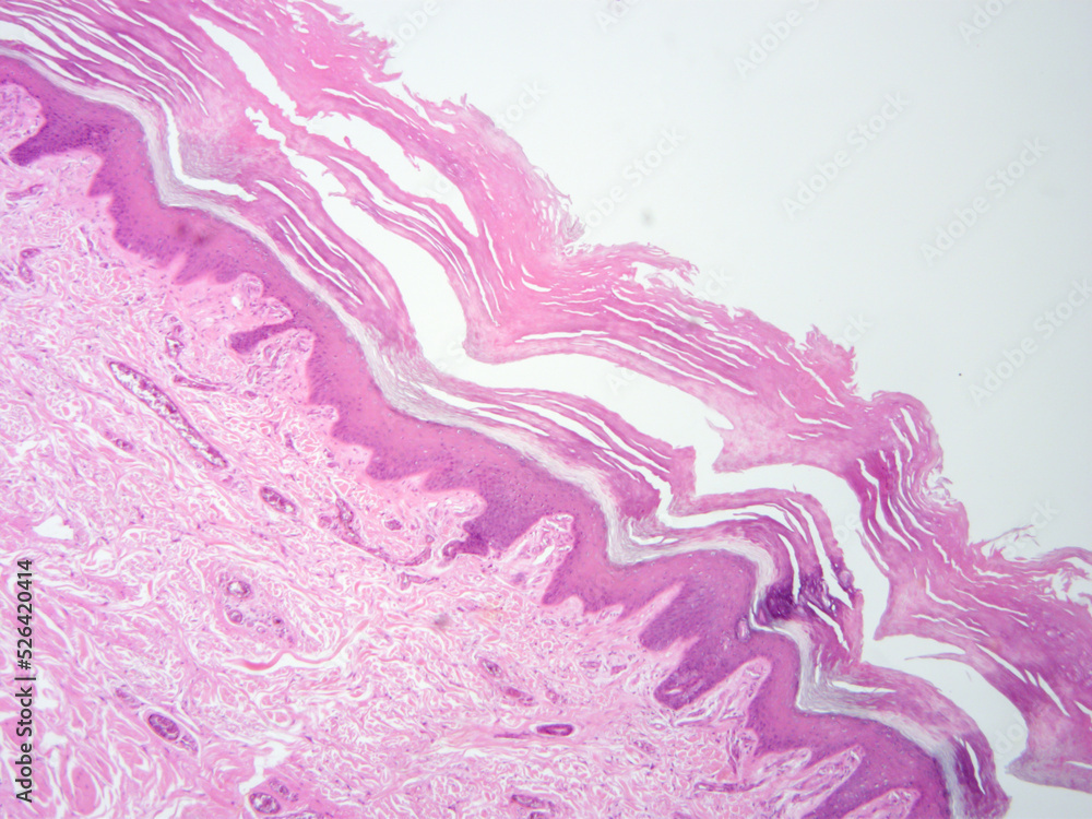Histology of human tissue, show epithelial tissue and connective tissue ...
