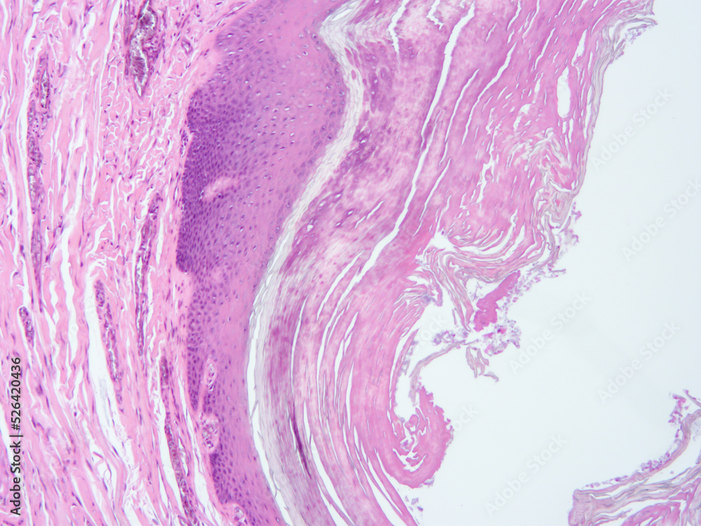 Histology of human tissue, show epithelial tissue and connective tissue ...
