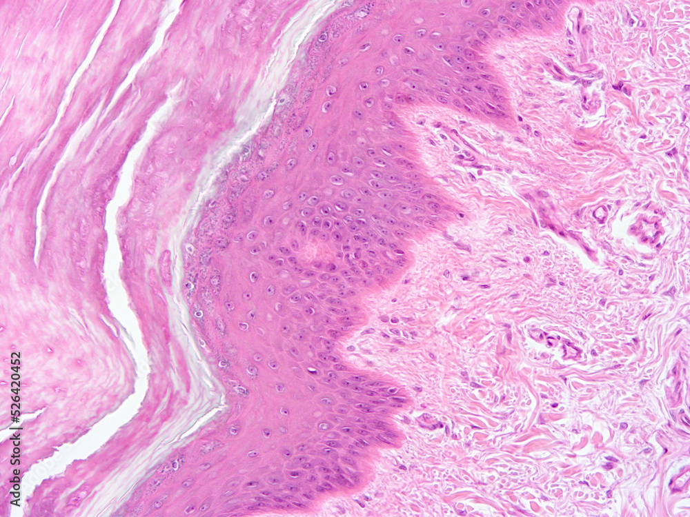 Histology of human tissue, show epithelial tissue and connective tissue ...