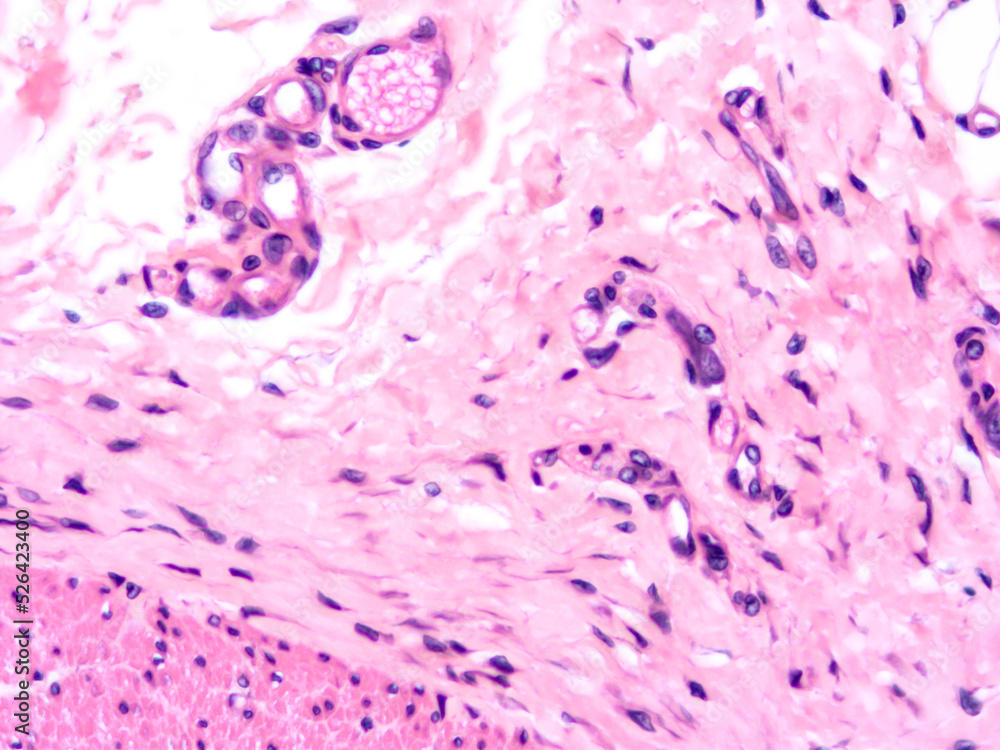 Histology of human tissue, show epithelial tissue and connective tissue ...