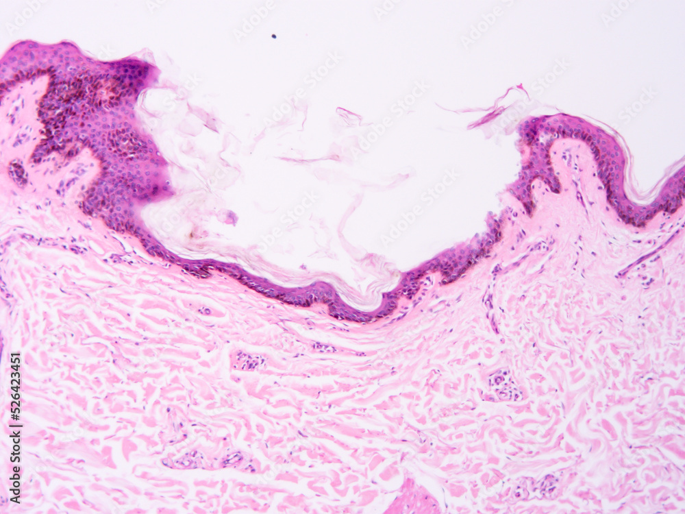 Histology of human tissue, show epithelial tissue and connective tissue ...