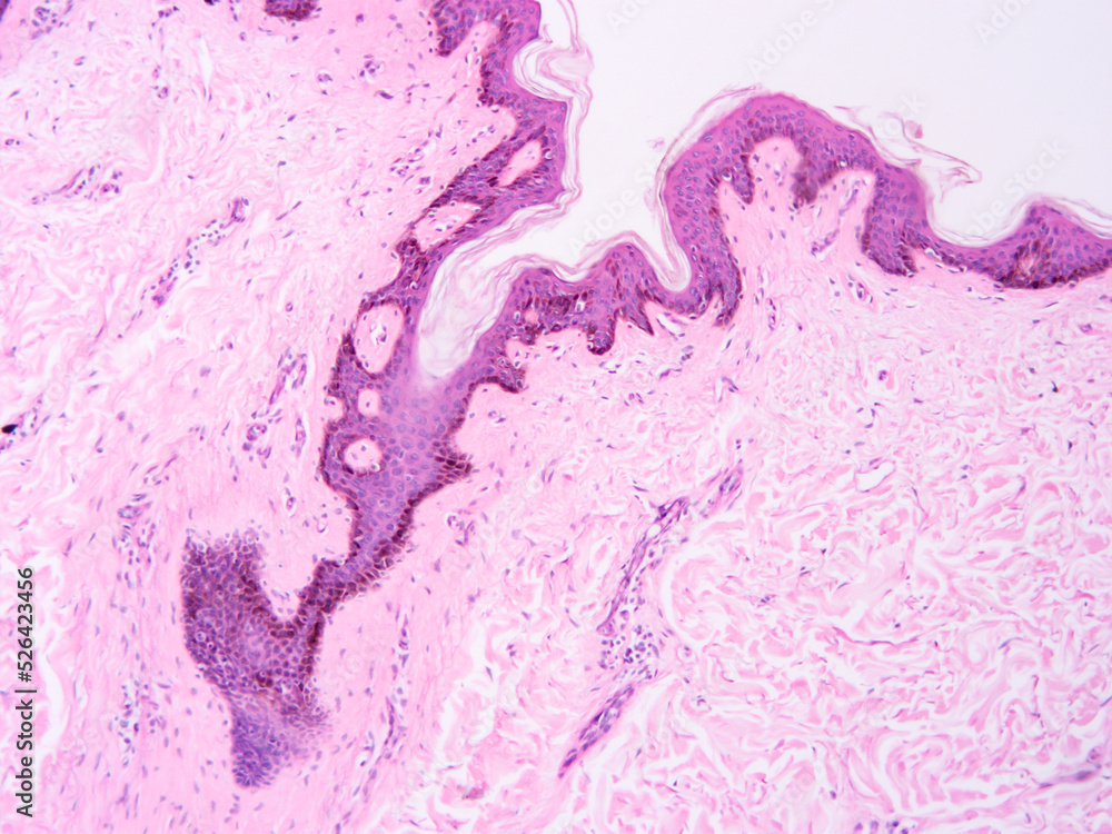 Histology of human tissue, show epithelial tissue and connective tissue ...