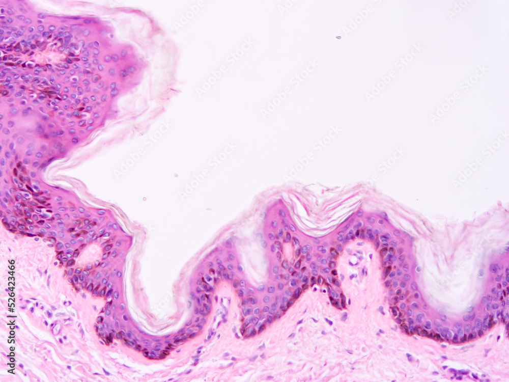 Histology of human tissue, show epithelial tissue and connective tissue ...