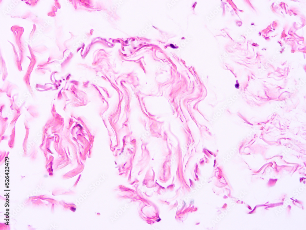 Histology of human tissue, show epithelial tissue and connective tissue ...