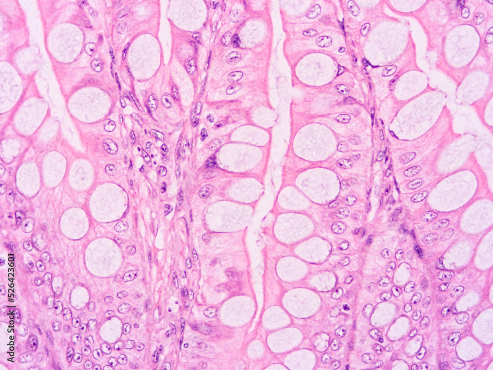 Histology of human tissue, show epithelial tissue and connective tissue ...