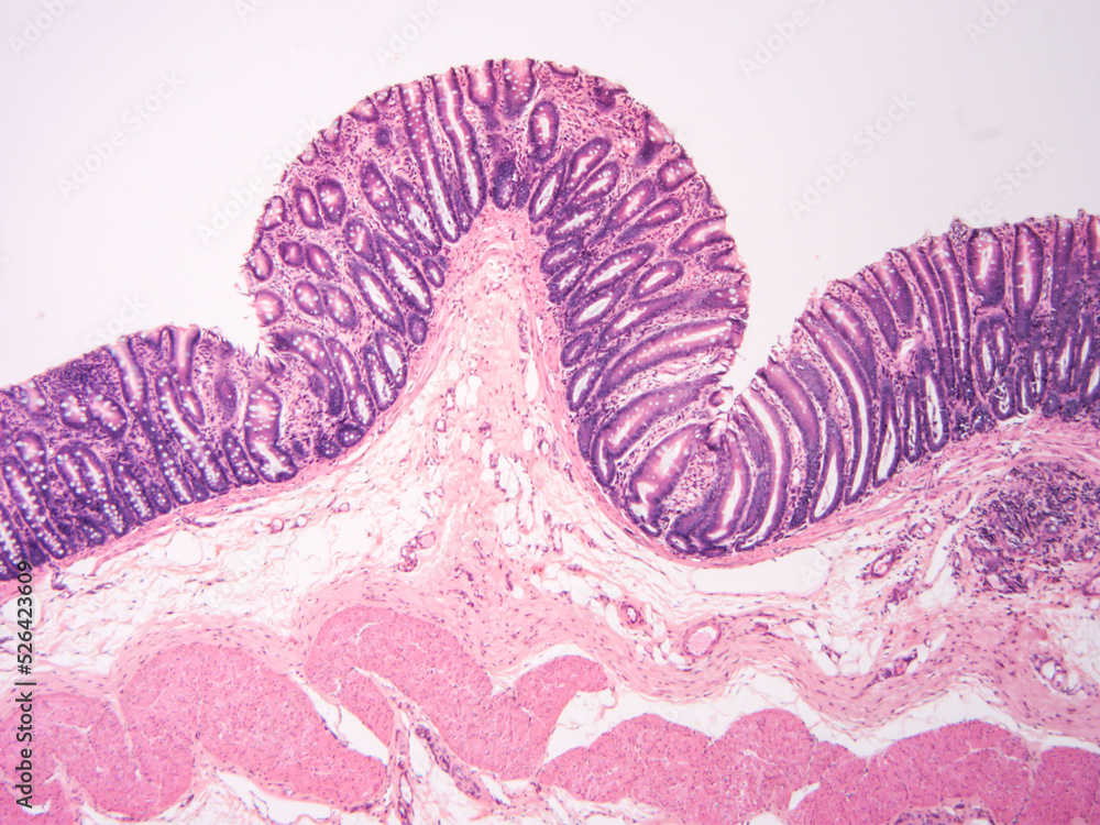 Histology of human tissue, show epithelial tissue and connective tissue ...