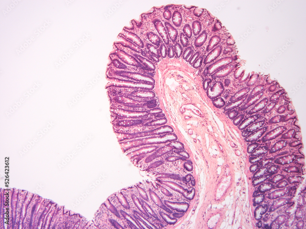 Histology of human tissue, show epithelial tissue and connective tissue ...