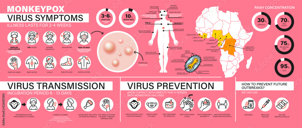Monkeypox virus symptoms, transmission and prevention. Large detailed ...