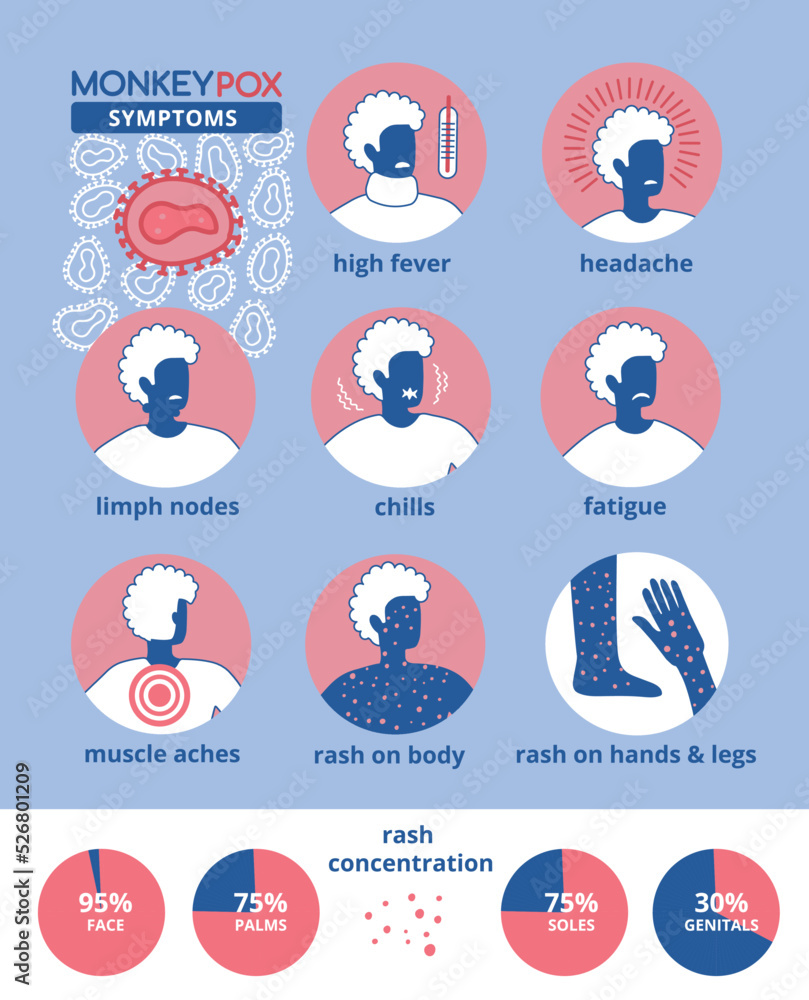 Monkeypox virus symptoms round icons with Afro black man silhouette ...