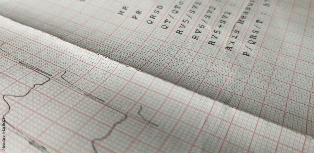 Heart beat rate frequency and rhythm test medical and health ...
