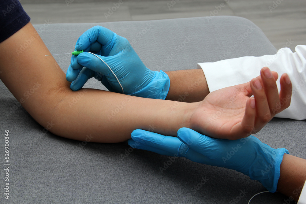 Foto de Electromyography is a graphic recording technique of the ...