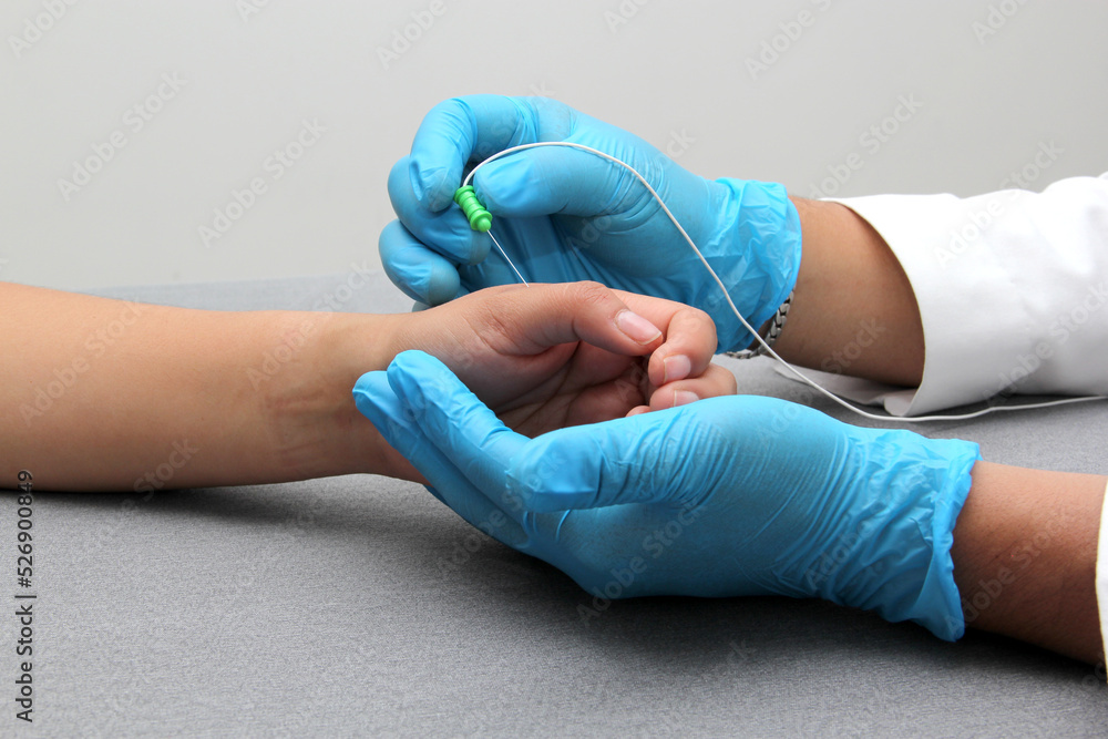 Electromyography is a graphic recording technique of the electrical ...