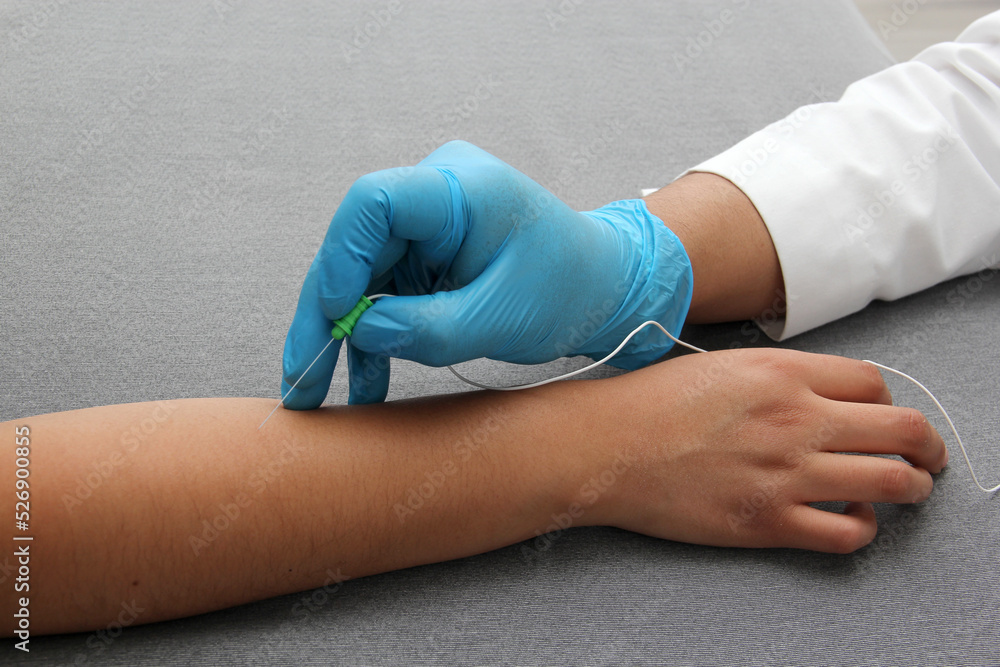 Electromyography is a graphic recording technique of the electrical ...